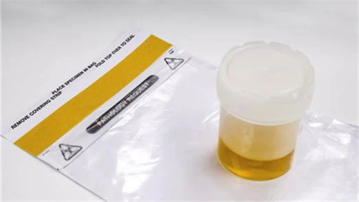 臨床研究 内分泌学とビタミン分析 | アジレント・テクノロジー